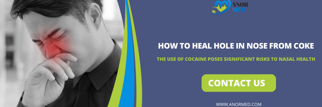 How to Heal Hole in Nose From Coke | Anormed UK